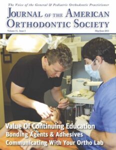 Distalizing Upper Molars | Orthodontics for General Dentists