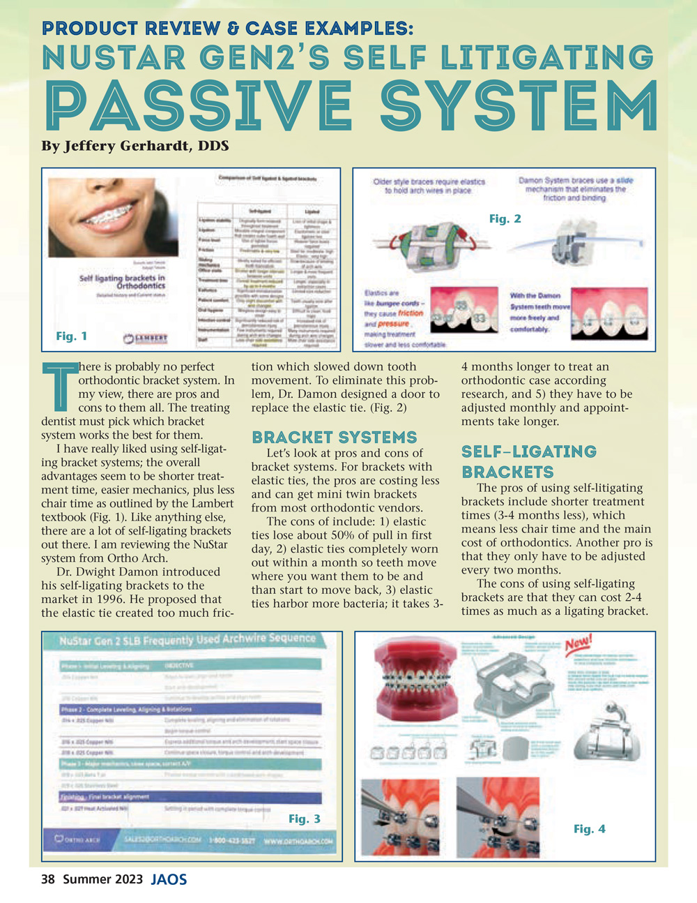 Dr. Gerhardt’s Product Review: Nustar Gen2’s Self Litigating Passive ...